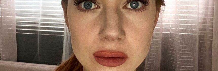 Model can't get work after botched nose job leaves her with ‘wonky ...